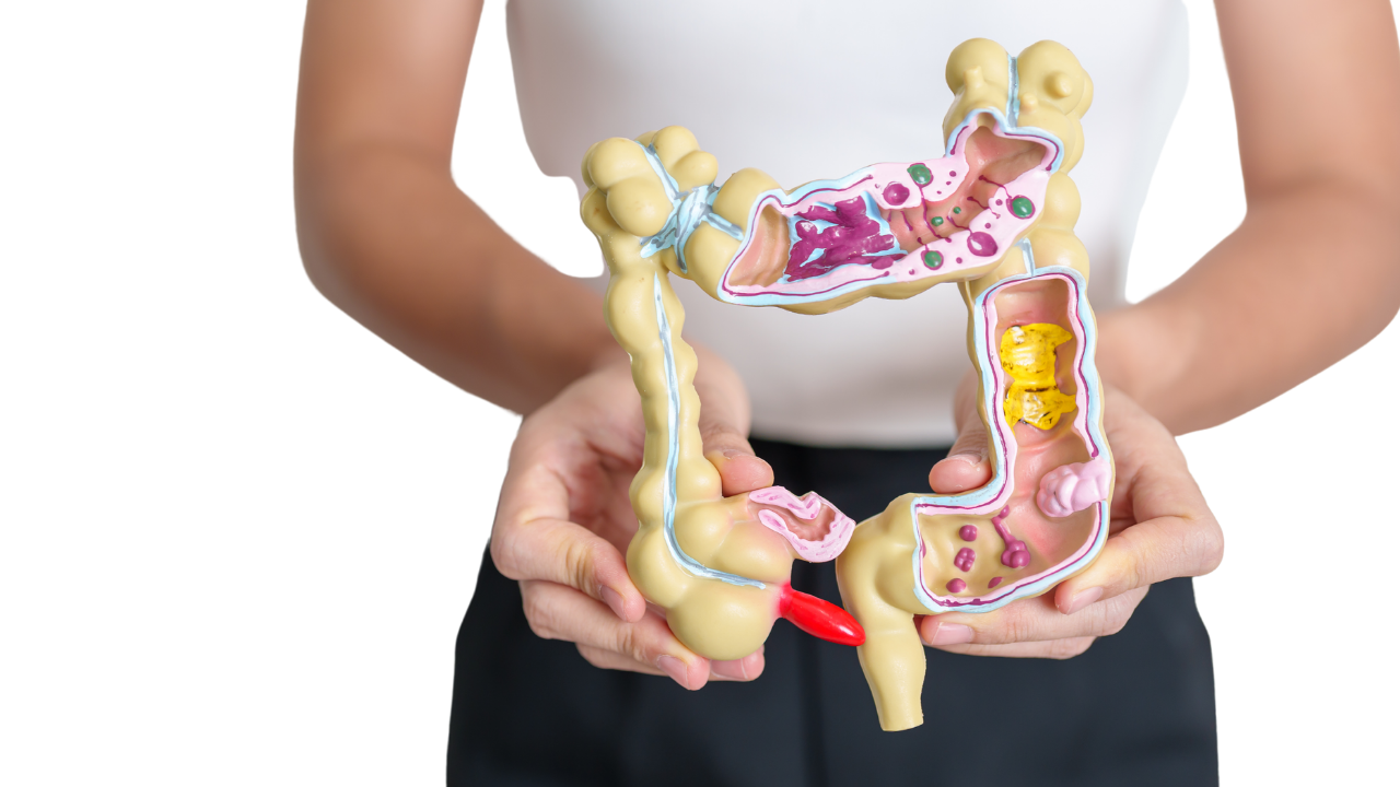 Ulcerative Colitis An Inflammatory Bowel Disease Genes Cure 2161