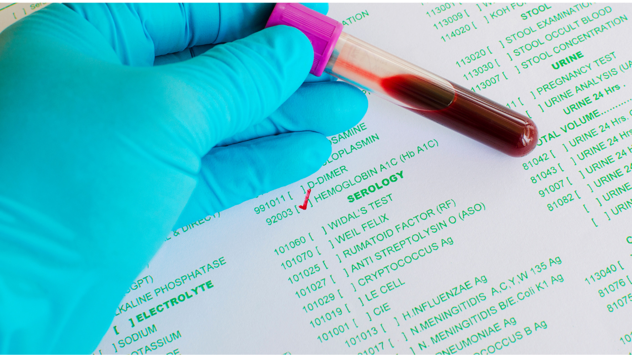 UGT1A1 Testing (for irinotecan toxicity) - Genes Cure